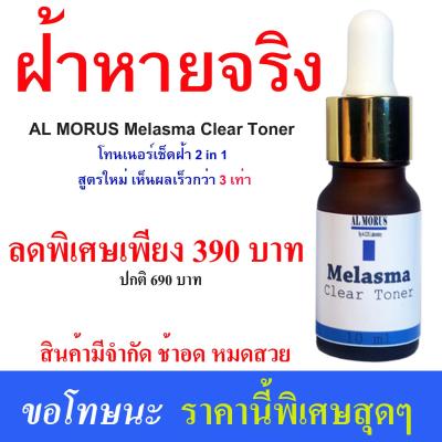 AL MORUS Melasma Clear Toner โทนเนอร์เช็ดฝ้าสูตรใหม่ ช่วยให้ฝ้าจางลง ...